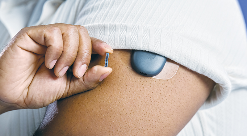 Mercy implants first-ever 365-day continuous glucose monitor